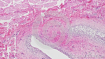 Transitional Epithelium of Man in Section Filmed Under Microscope 100x ...