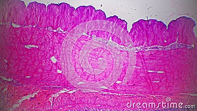 Transversal Section of Large Intestinal Under Microscope 40x for ...