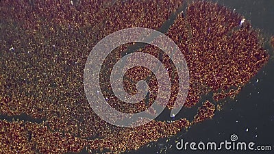 Thymus in Transversal Section Magnified Under Microscope in 100 Times ...