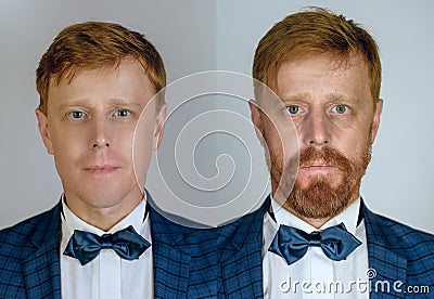Two Different Photos Of The Same Ginger Bearded Man In Different Ages ...