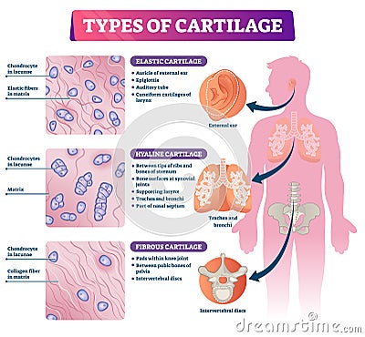 Types Of Cartilage Vector Illustration. Labeled Educational Tissue ...