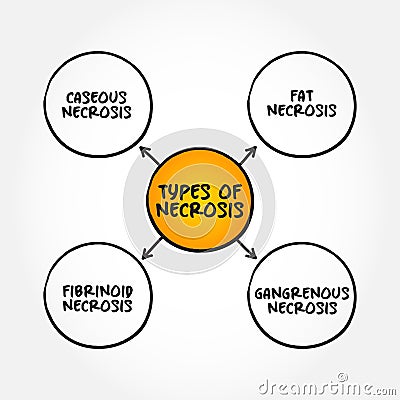 Types Of Necrosis (death Of Body Tissue) Mind Map Text Concept For ...