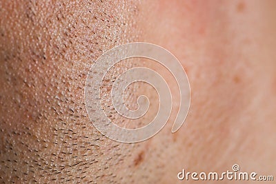 Unshaved Skin. Royalty-Free Stock Photography | CartoonDealer.com #47227133
