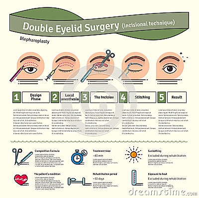 Vector Illustrated Set With Double Eyelid Surgery Stock Photo ...