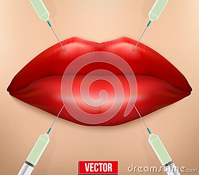 Vector Illustration Of A Botox Injection. | CartoonDealer.com #41912852