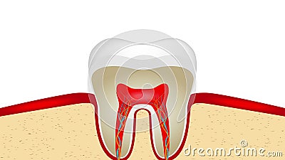 Stages of Tooth Decay or Dental Caries Stock Footage - Video of flat ...
