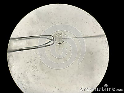 View Through Microscope At In Vitro Fertilization Process Stock Photo ...