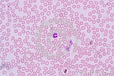 White Blood Cells Are The Cells Of The Immune System Under The ...