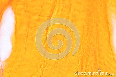 White Fibrous Cartilage Of Human Under The Microscope. Royalty-Free ...