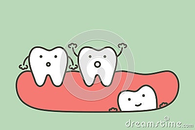 Wisdom Tooth Angular Or Mesial Impaction Affect To Other Teeth Vector ...