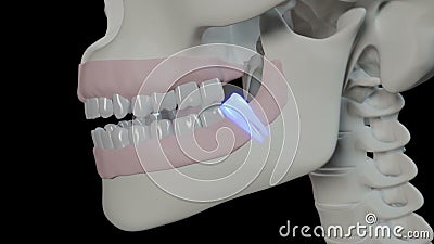 Wisdom Tooth Inflammation Overview Stock Footage - Video of oral ...