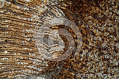 Wood And Bark Cells Of A Sudanese Frankincense Tree, Boswellia ...