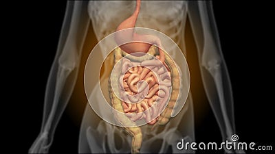 X-ray of the Gastrointestinal Tract. Radiography of the Stomach Stock ...