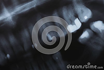 X-ray Scan Of Humans Teeth Stock Photo | CartoonDealer.com #31789698