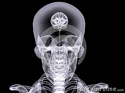X-ray Small Brain Royalty-Free Stock Photography | CartoonDealer.com ...