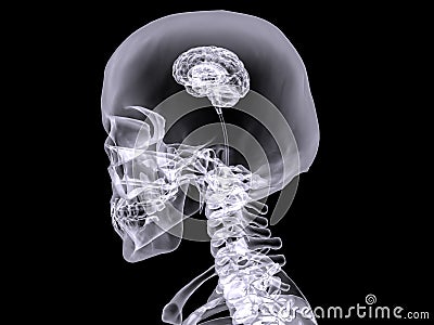 X-ray Small Brain Stock Image | CartoonDealer.com #41056681