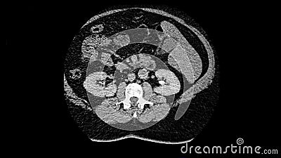 X-ray Visualization Medical Diagnostics MRI Scans for Clinical Analysis ...