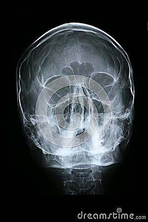 Xray/Face side stock image. Image of health, disease, diagnosis - 198831