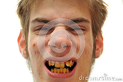 Yellow Teeth Stock Photos - Image: 11658263