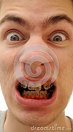 Yellow Teeth Stock Photos - Image: 13000723