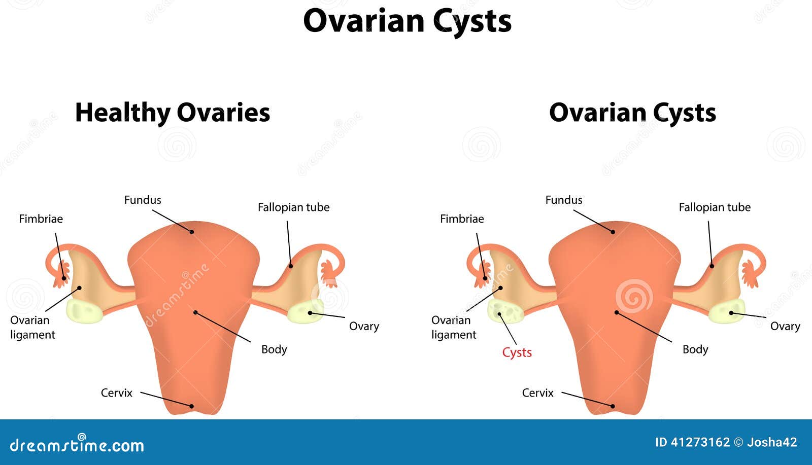 Cystor Stock Illustrationer, Vektorer, & Clipart – (386 Stock ...