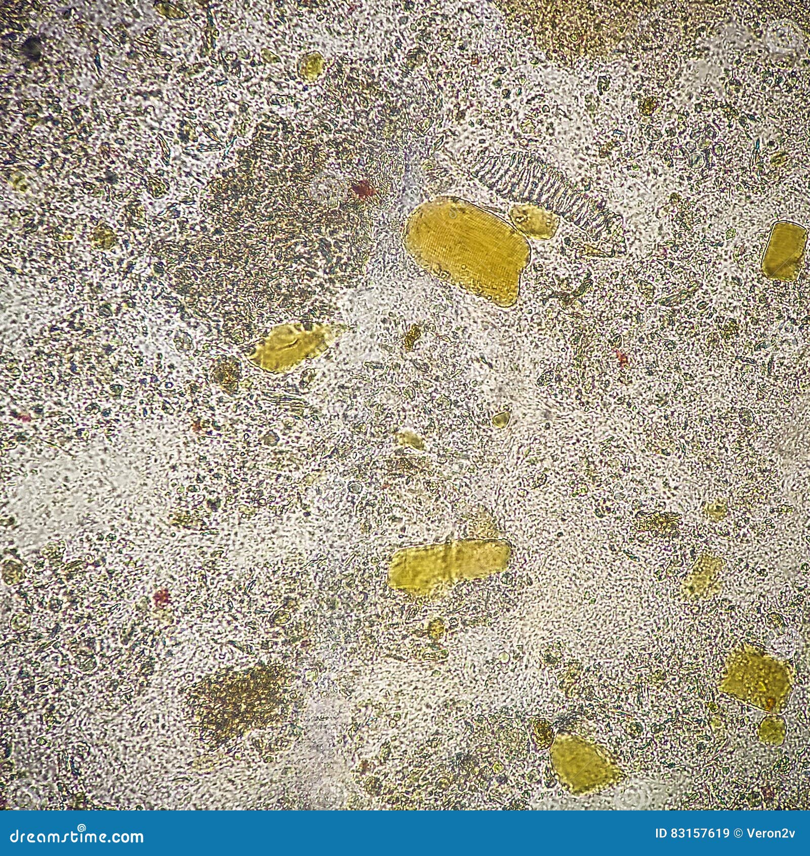 Échantillon De Selles Humain Sous Le Microscope Image stock - Image of ...