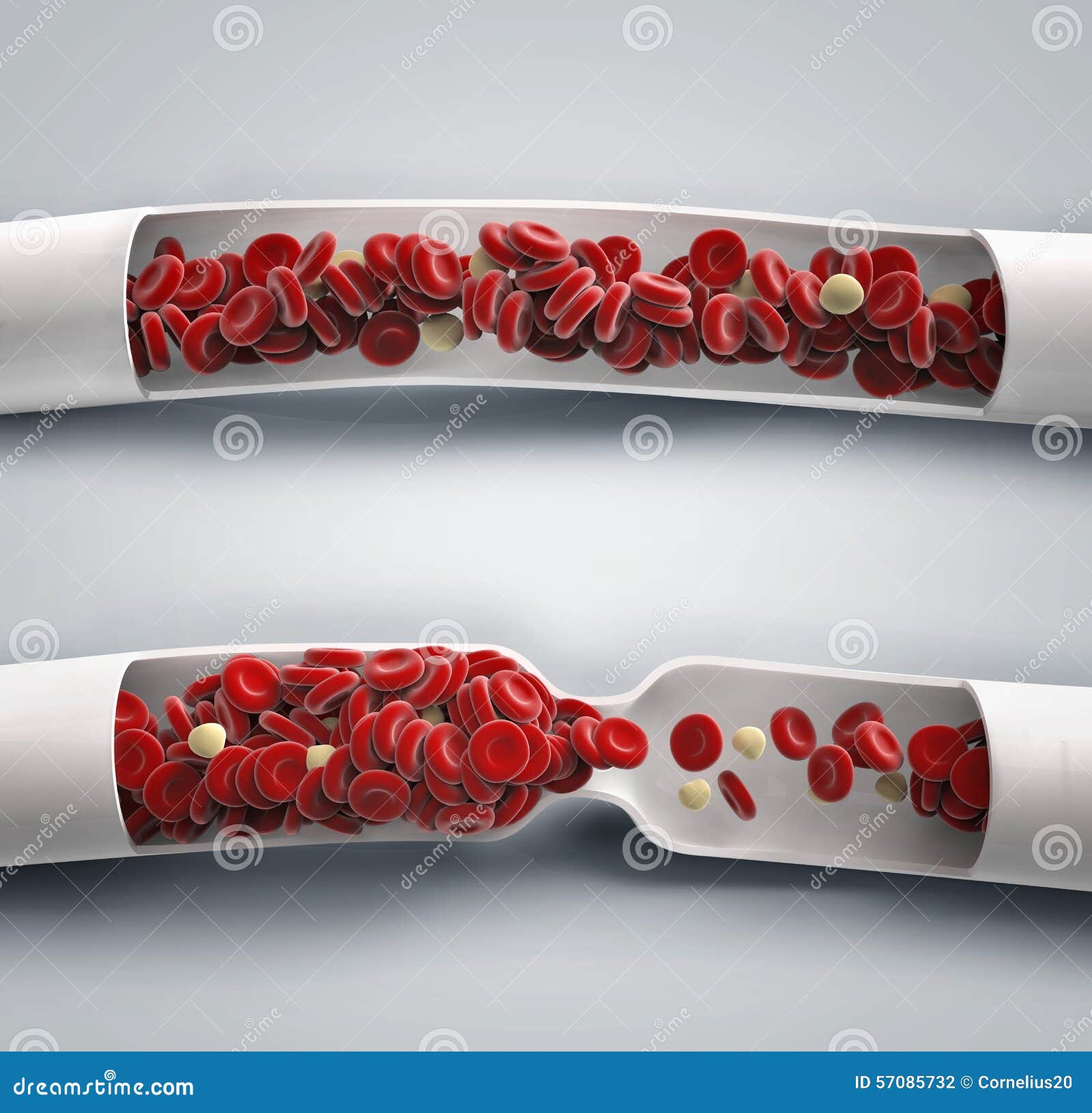 Écoulement Et Caillot Sanguin De Sang Illustration Stock - Illustration ...