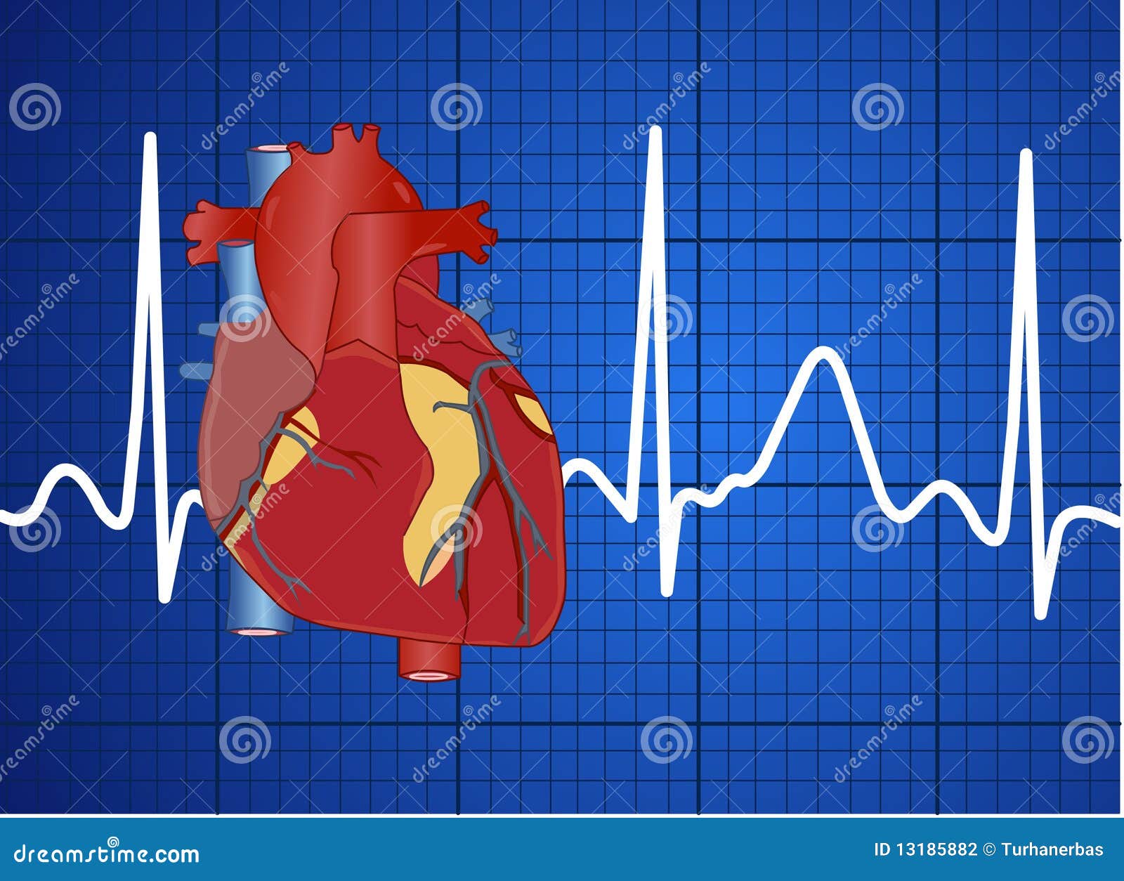 Électrocardiogramme illustration de vecteur. Illustration du médical ...
