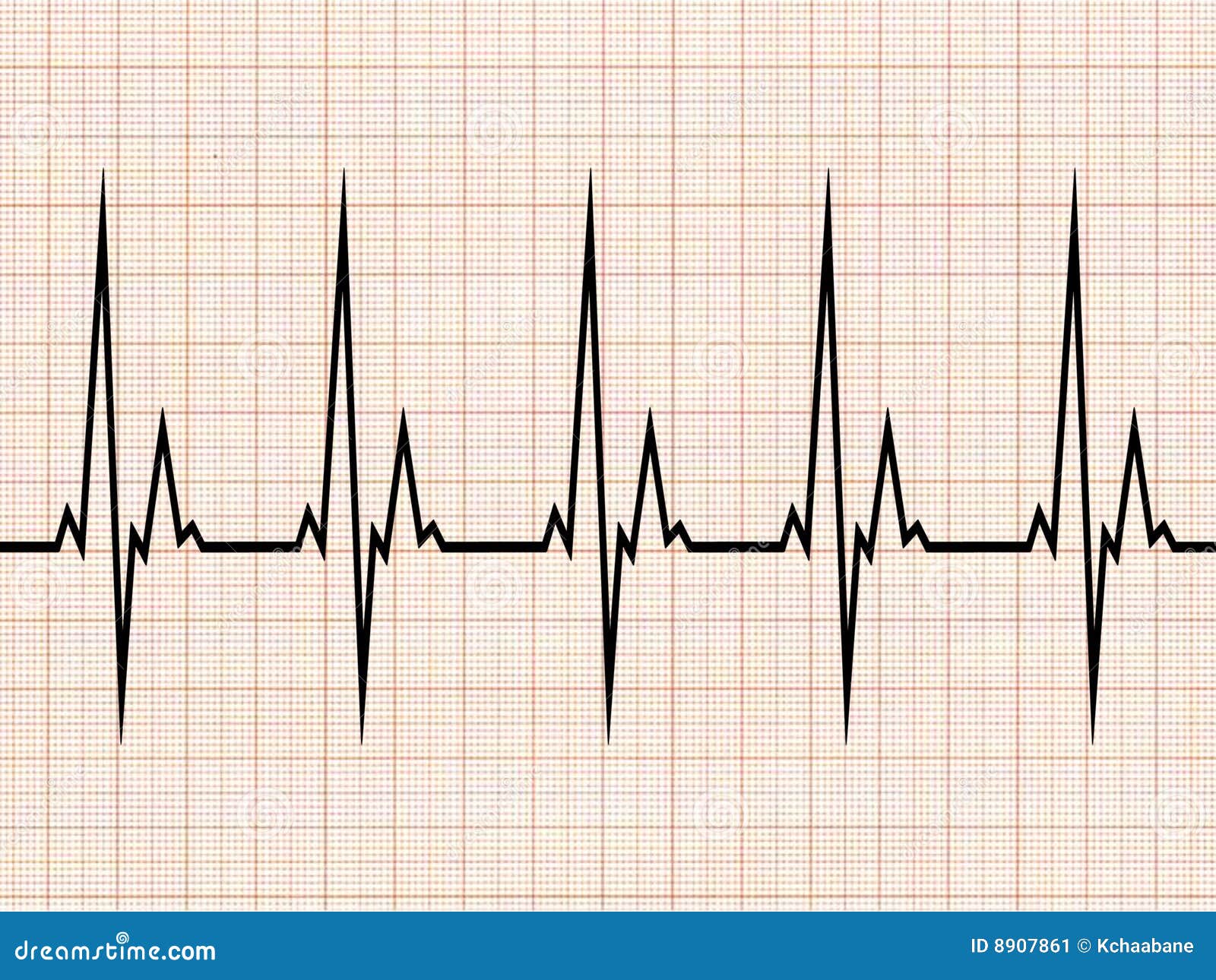 Électrocardiogramme illustration stock. Illustration du coeur - 8907861