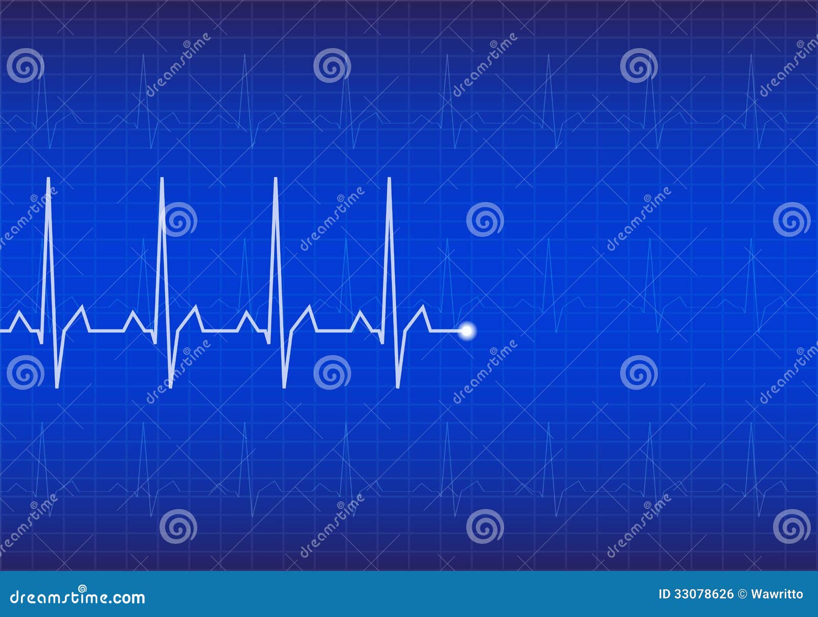 Électrocardiogramme d'ECG, illustration stock. Illustration du ...