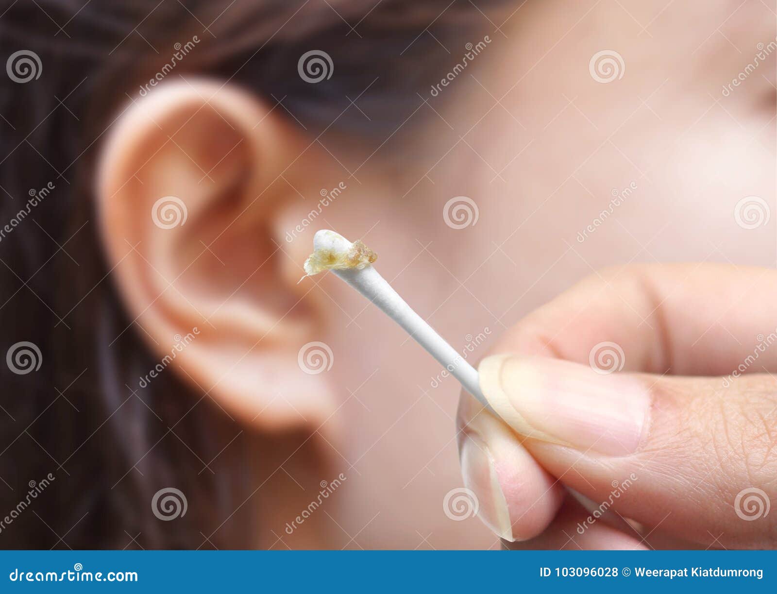 Élimination De La Cire D'oreille Photo stock - Image du main, doux ...