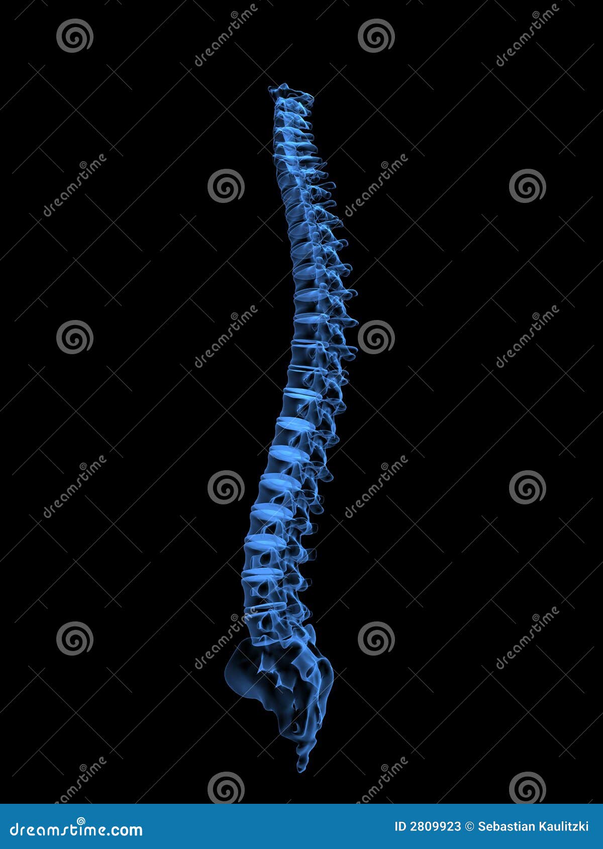 Épine D'être Humain De Rayon X Illustration Stock - Illustration du ...