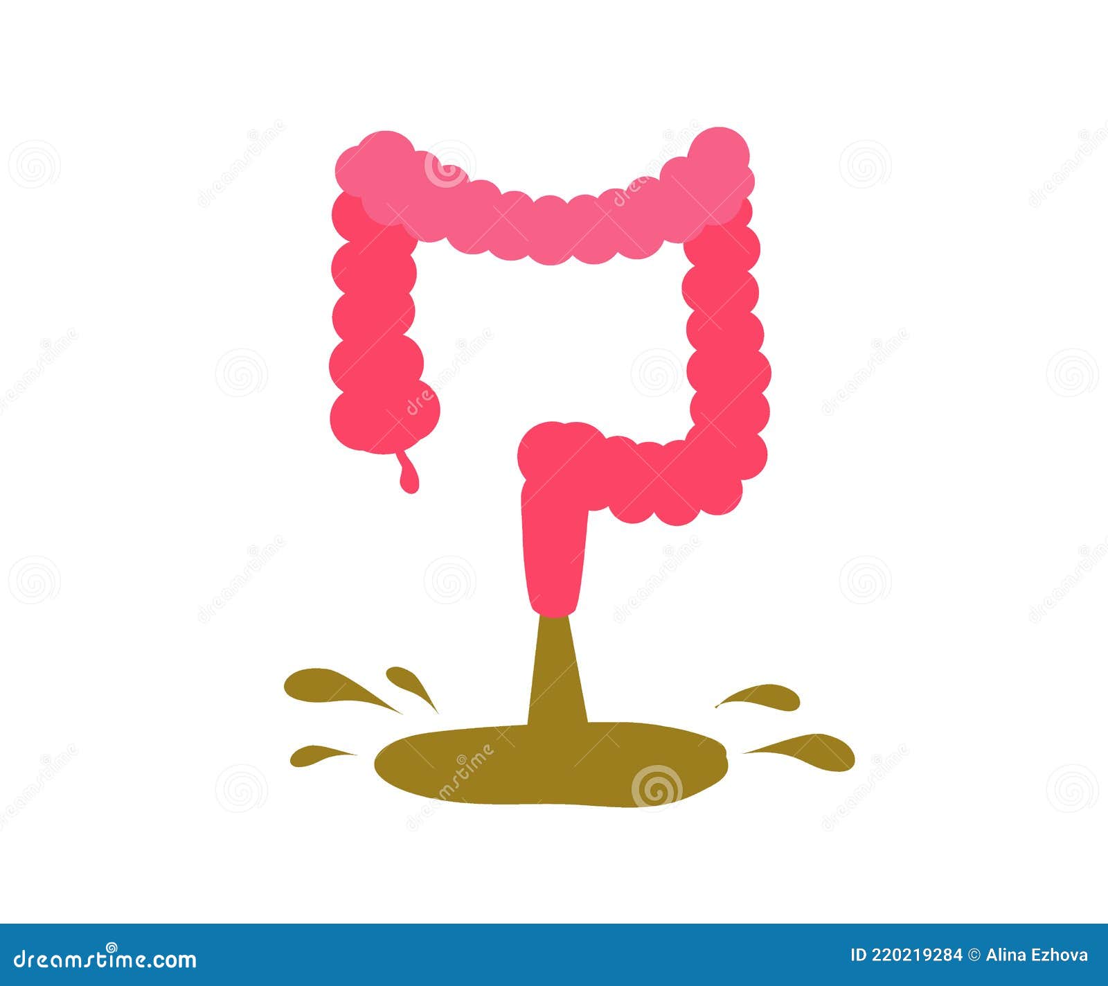 Large Intestine on a White Background. Diarrhea Stock Vector ...