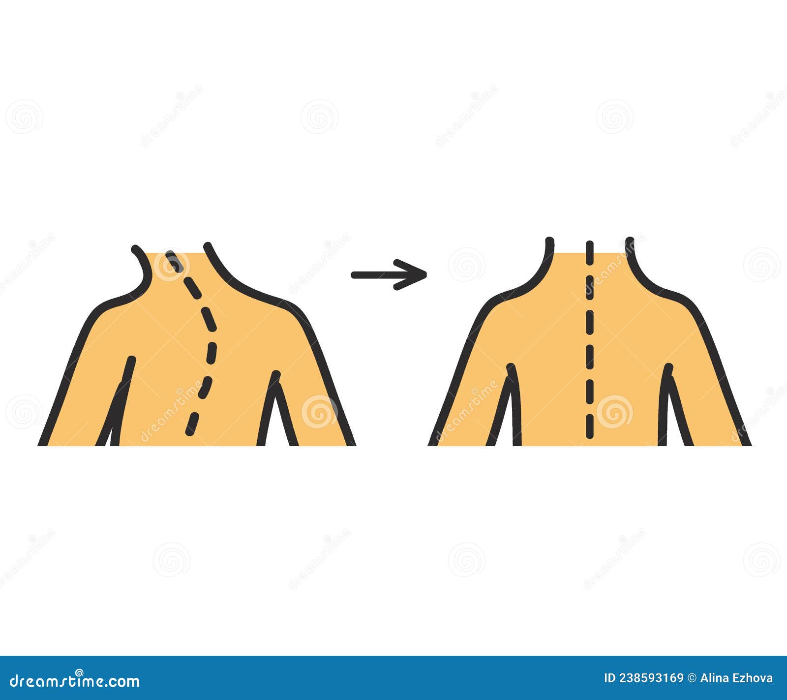 Human Spine on a White Background. Poor Posture. Symbol Stock Vector ...