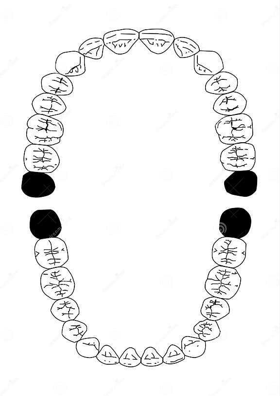 32 teeth stock illustration. Illustration of medical, teeth - 9620955