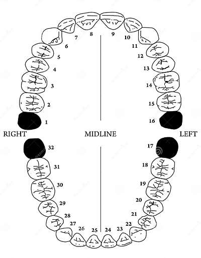 32 teeth stock illustration. Illustration of dental, orthodontist - 9620958