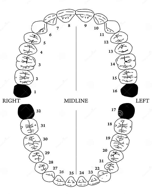 32 teeth stock illustration. Illustration of dental, orthodontist - 9620958