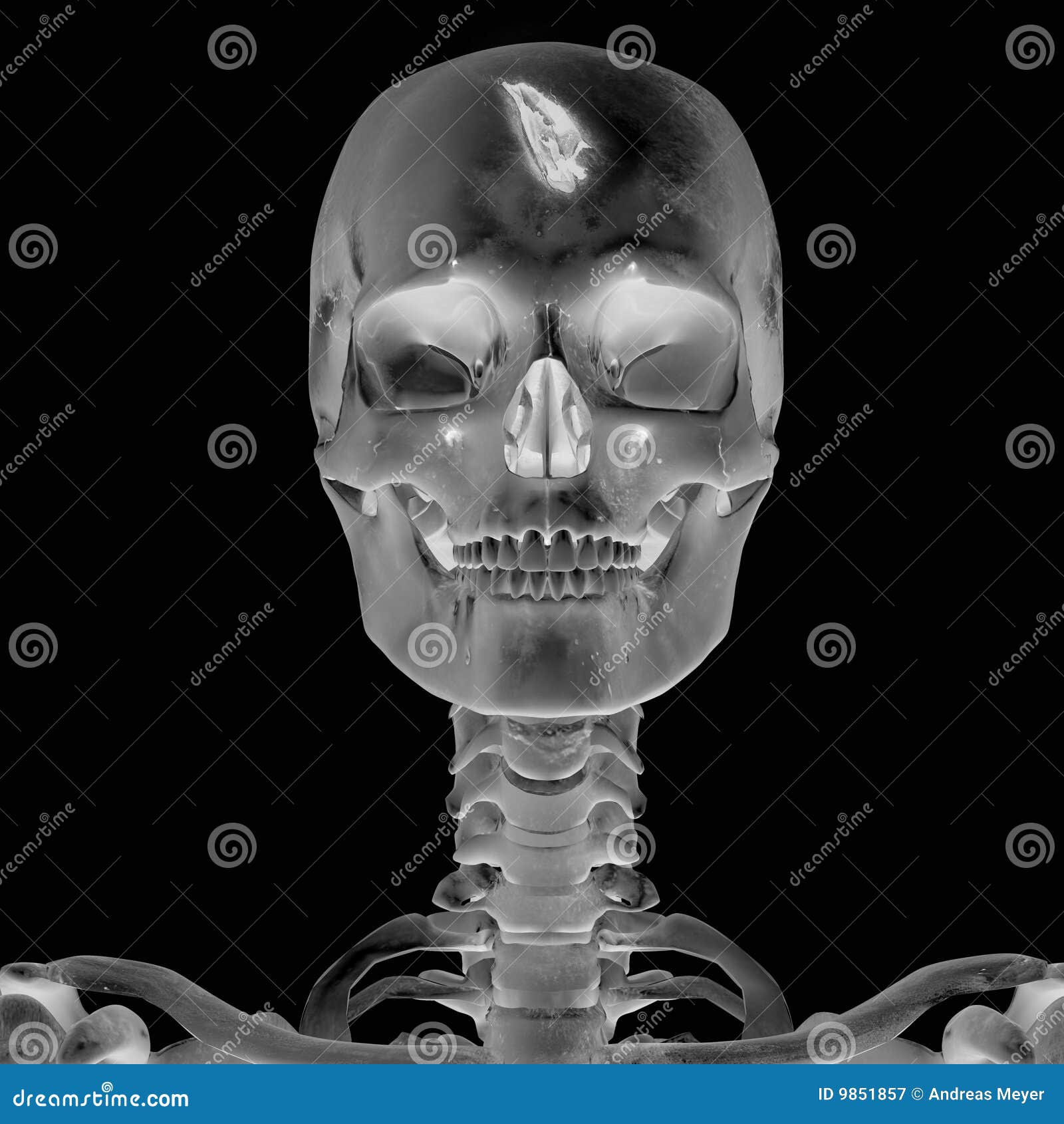 3D Radiograph with Head Injury Stock Illustration - Illustration of ...