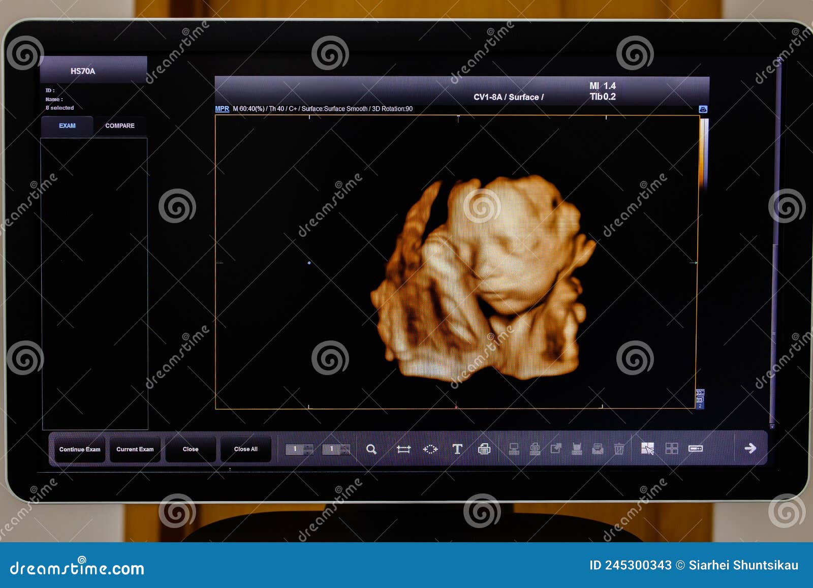 Abbildung 4d Mit Ultraschall Des Babys Im Mutterleib Zeigt Das Gesicht ...