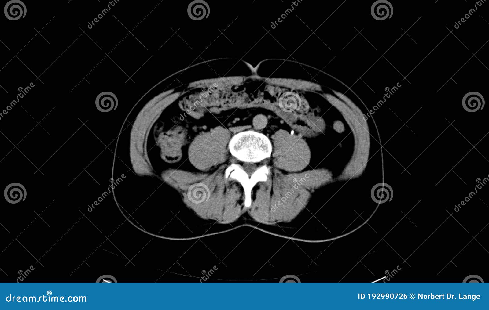 Abdomen human, man stock photo. Image of medicine, pelvis - 192990726