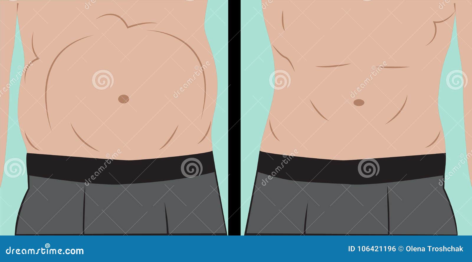 Abdominal bloating stock vector. Illustration of problem - 106421196