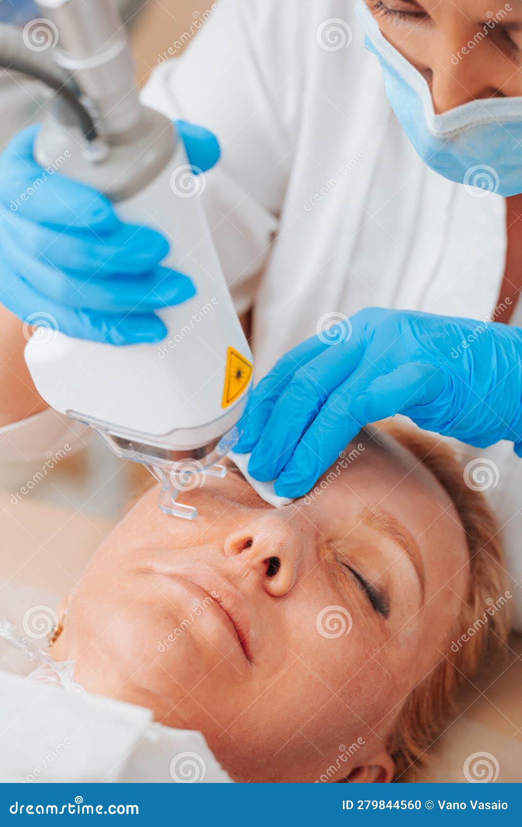 The Ablative Laser Removes the Thin Outer Layer of the Skin Stock Photo ...