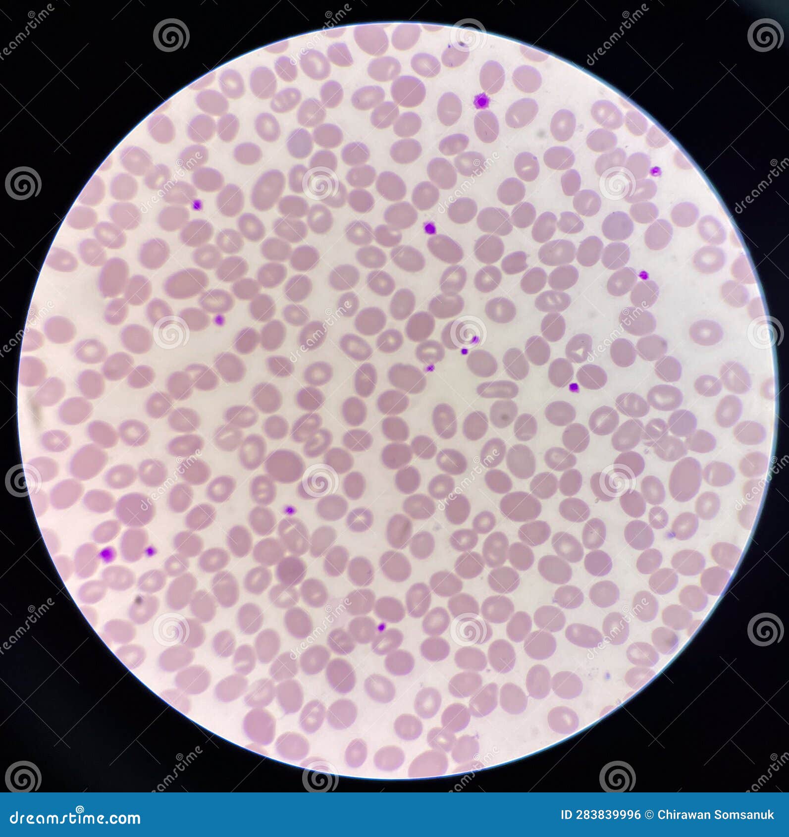 Abnormal Cell Blood Smear Science Concept Stock Image | CartoonDealer ...