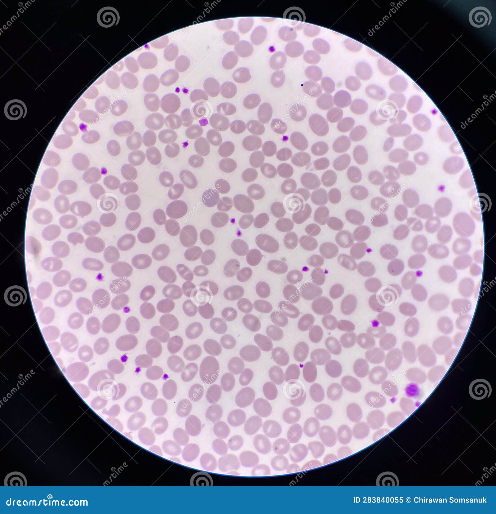 Abnormal Cell Blood Smear Science Concept Stock Image | CartoonDealer ...