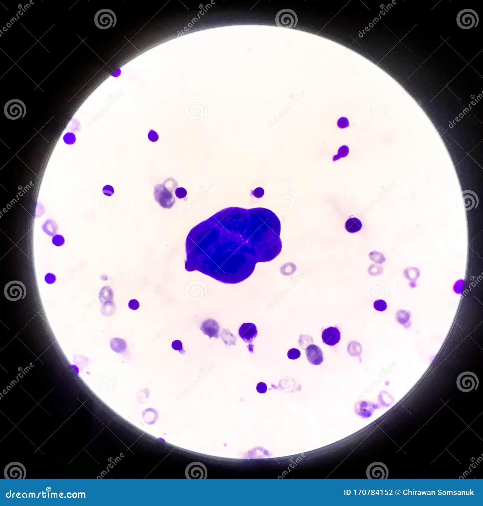 Pleural Fluid Cells Images
