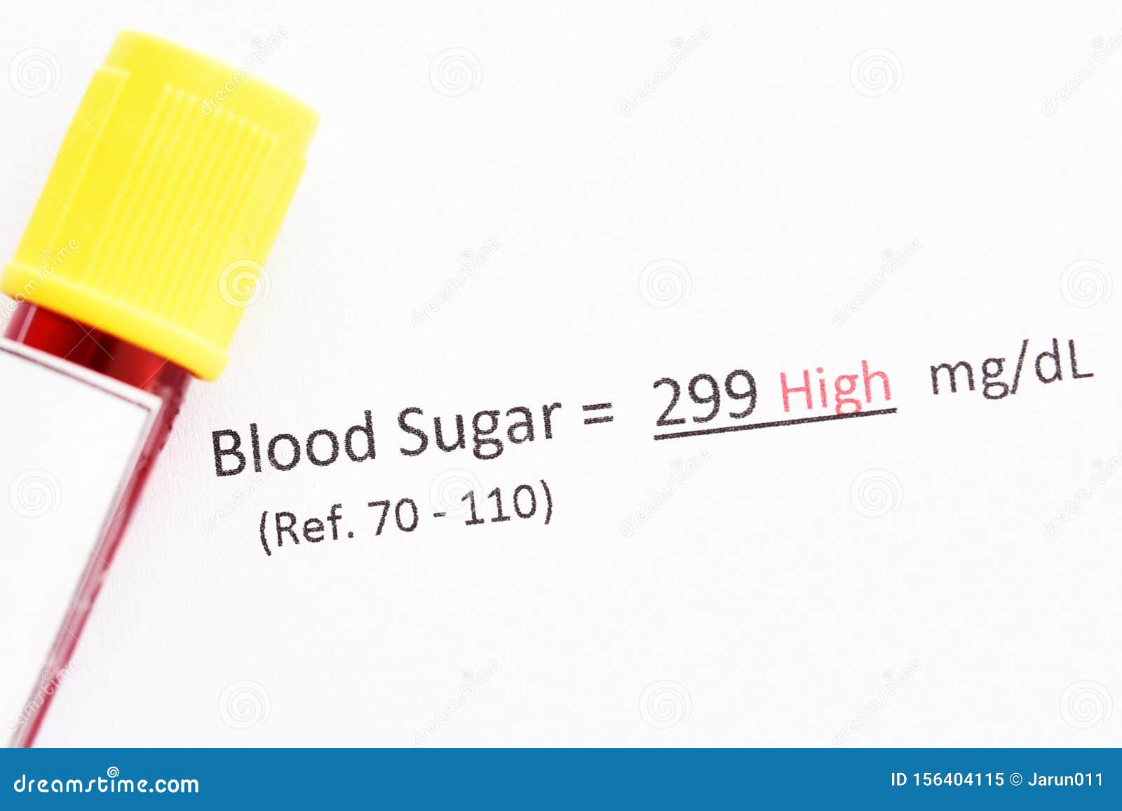 Abnormal High Blood Sugar Test Result Stock Image - Image of renal ...