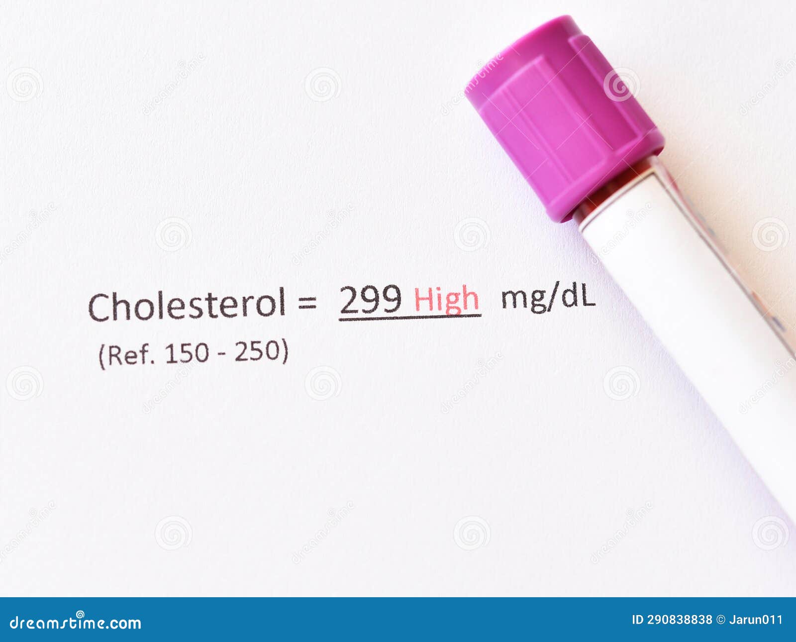 Abnormal High Results Of Lipid Profile And Blood Sugar Test Royalty ...