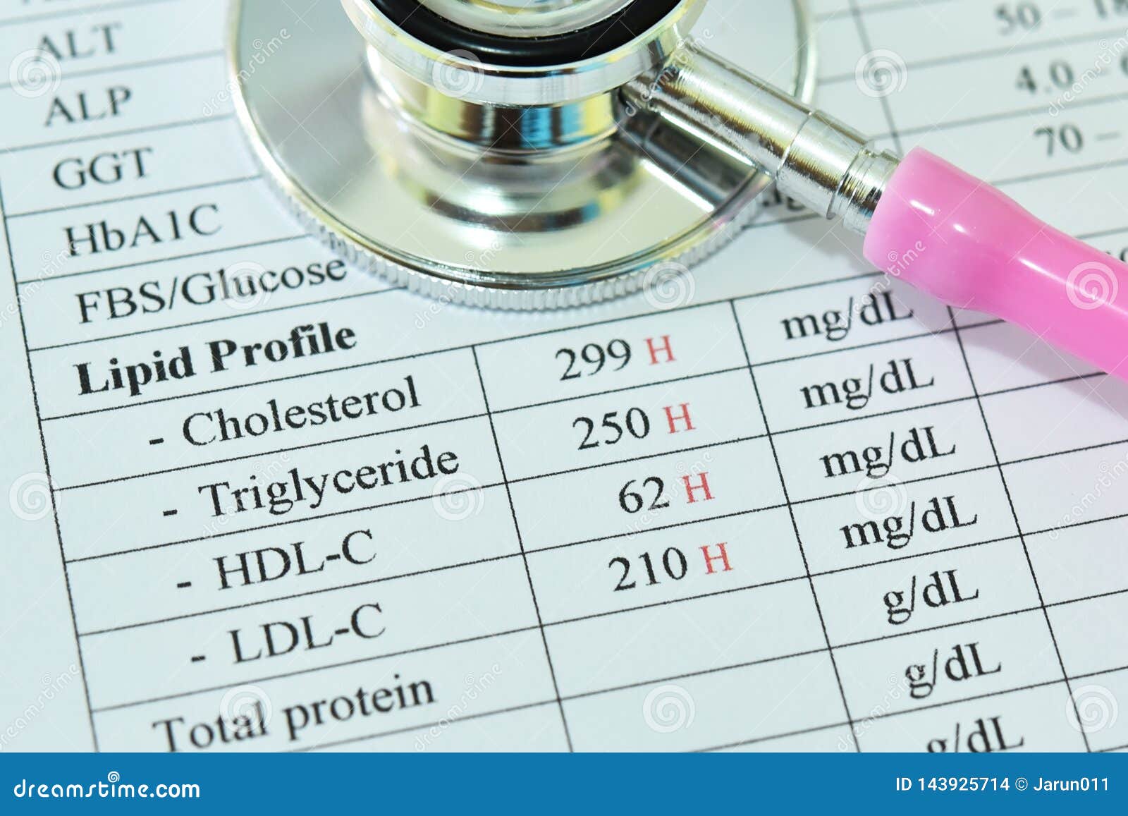 Abnormal High Lipid Test Result Stock Photo - Image of clot, clinical ...