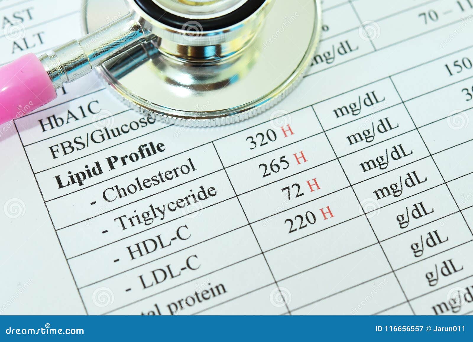 Abnormal High Lipid Test Result Stock Image - Image of diagnosis ...