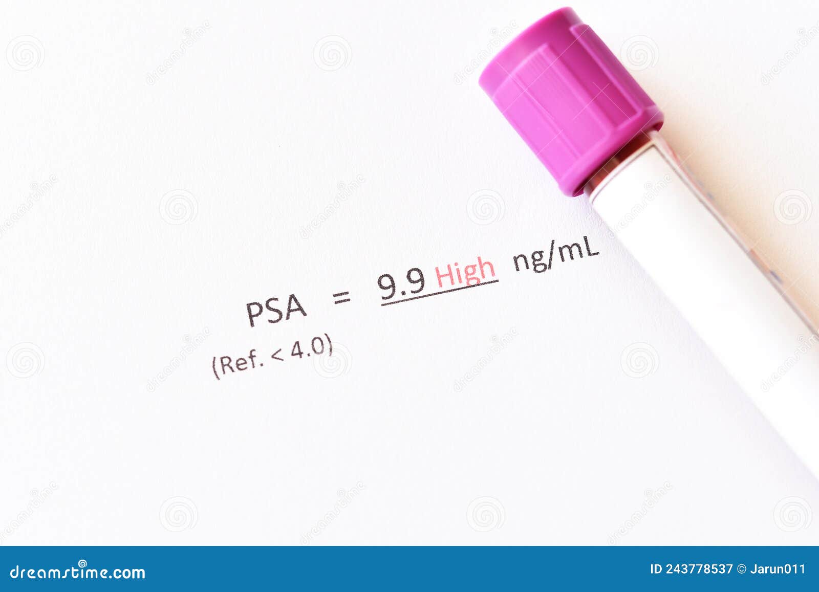 Abnormal High PSA Test Result Stock Image - Image of cancer, immunology ...